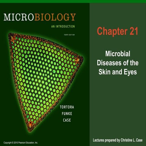 Microbial Diseases of the Skin and Eyes | PPT