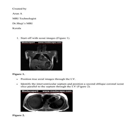 Cardiac MRI | PDF