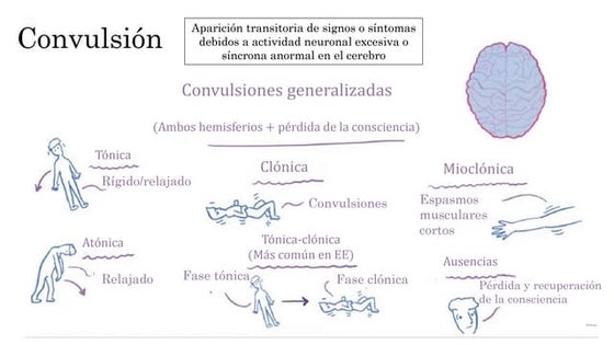 Estatus epiléptico en pediatría.pptx