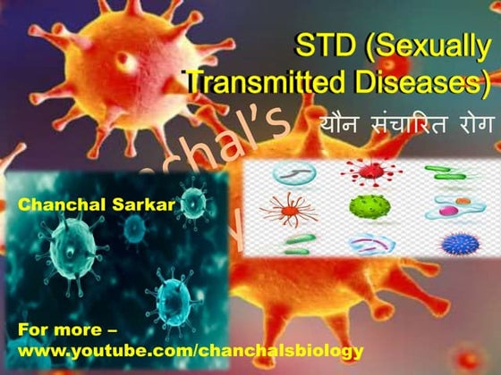 Sexually Transmitted Infections (STI’s) Presented By Theresa Lowry ...