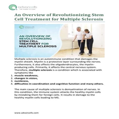 Revolutionizing Stem Cell Treatment for Multiple Sclerosis | PDF