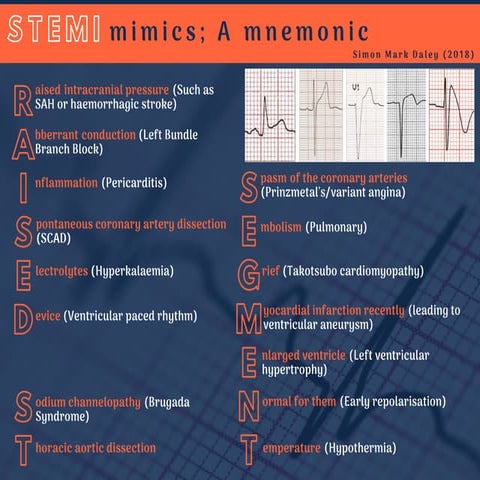 ST SEGMENT IN ECG,ST ELEVATION AND ST DEPRESSION | PPTX