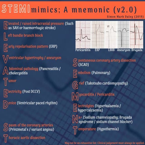 Stemi mimics v2 teaching resource | PDF