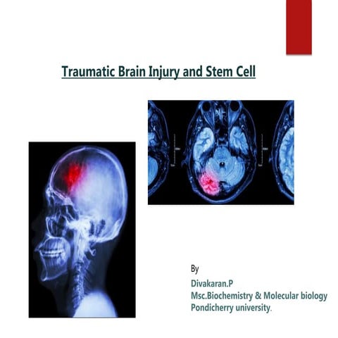stem cell and Traumatic brain injury | PPT