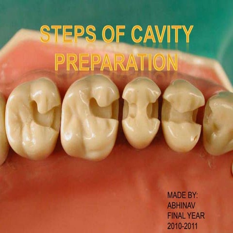Class II cavity preparation | PPTX