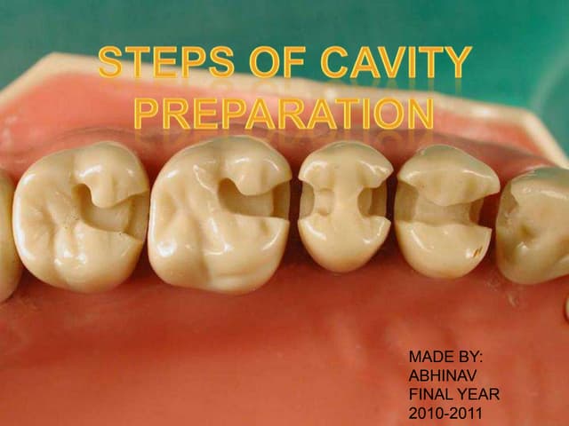Class II cavity preparation | PPTX