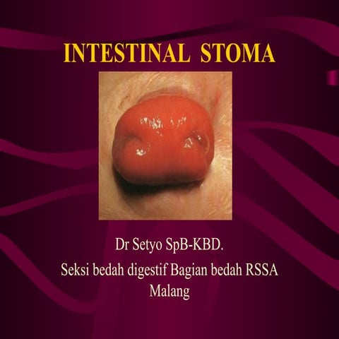 Ilmiah 1 Stoma Optek Bedah Digestive .ppt