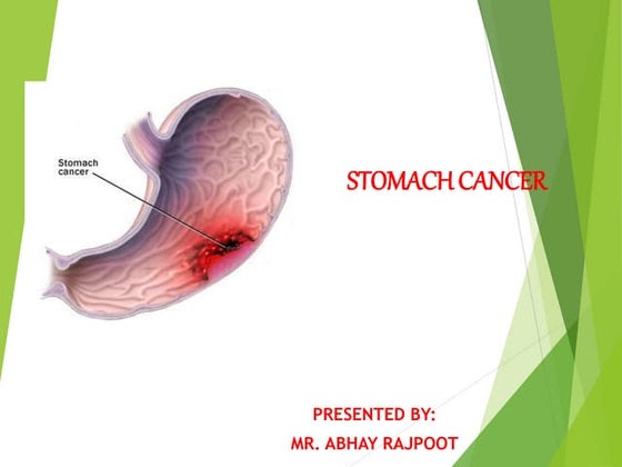 Gastric cancer | PPTX | Digestive Disorders | Diseases and Conditions