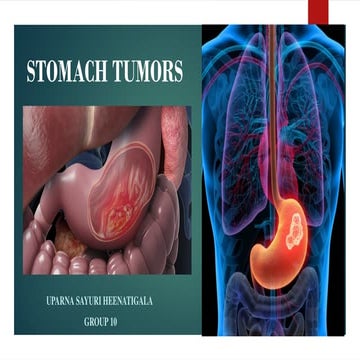 STOMACH CANCER-introduction to cancers-.pptx