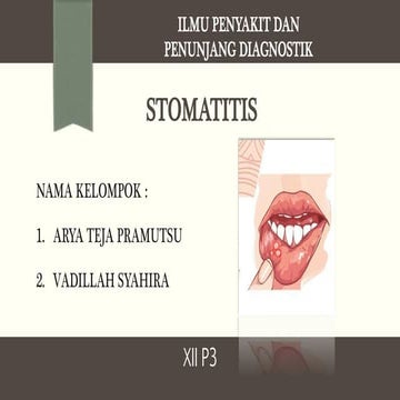 Stomatitis | PPTX