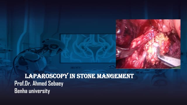 Ureteroscopic lithotripsy (URSL) | PPTX