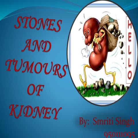 Types Of Kidney Calcifications