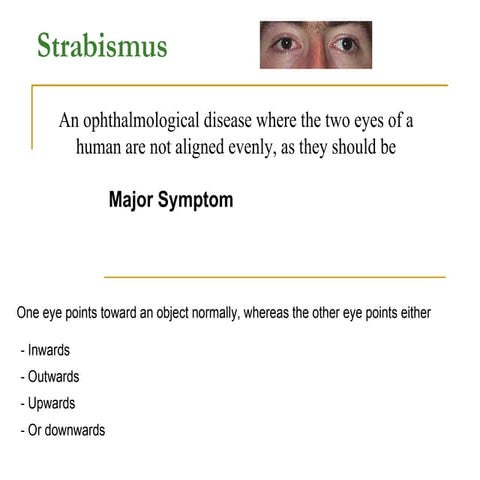 Strabismus | PPT | Eye and Vision Conditions | Diseases and Conditions