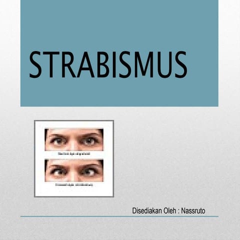 STRABISMUS | PPT