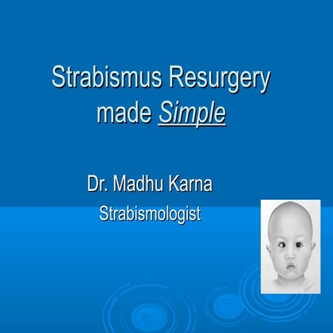 Strabismus surgery made simple: Dr. Madhu Karna Strabismologist | PPT