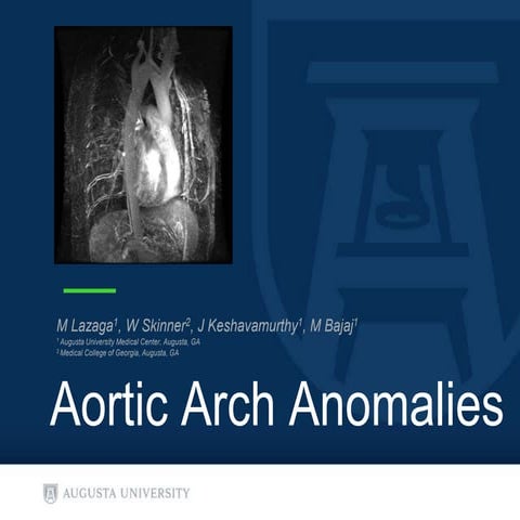 Aortic Arches A REVIEW E POSTER | PPTX