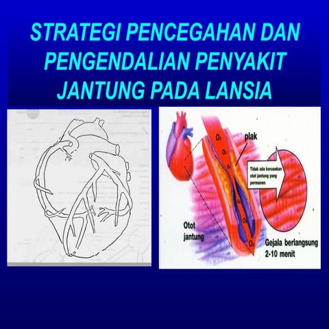 STRATEGI PENGENDALIAN PENYAKIT JANTUNG PADA LANSIA.pptx