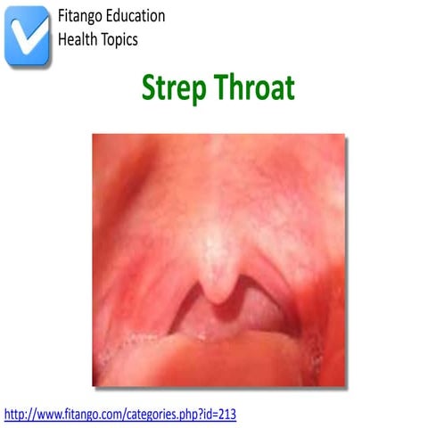Strep Throat | PPTX
