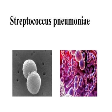 Streptococcus pneumonia | PPT