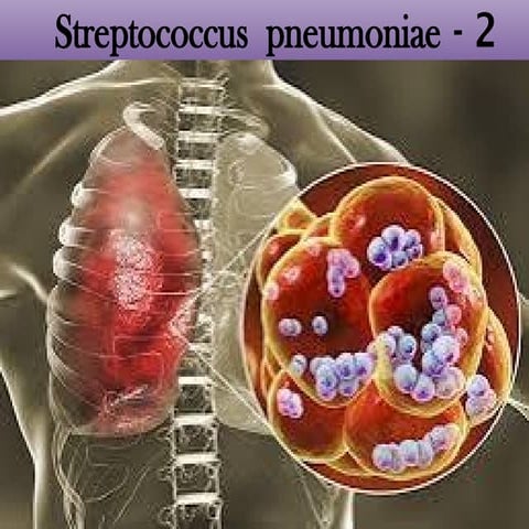 Streptococcus pneumoniae for laboratory students .pptx