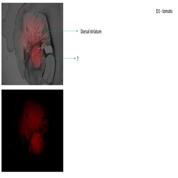 Direct and Indirect Pathways in Striatum.pptx