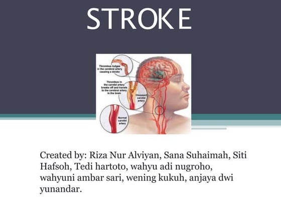 Stroke | PPT