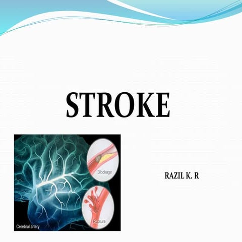 Ischaemic stroke | PPTX