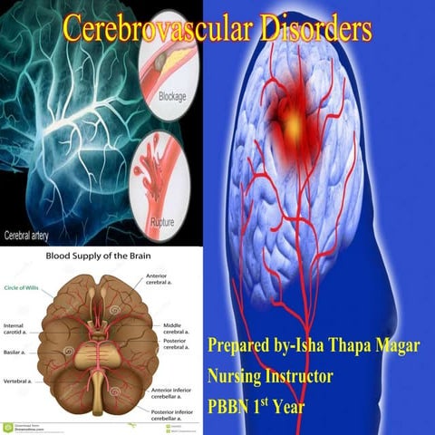 CVA - Cerebrovascular Accident / Stroke | PPTX