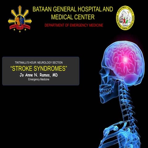 Stroke Syndromes | PPT