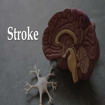 Introduction to stroke and its management | PPTX