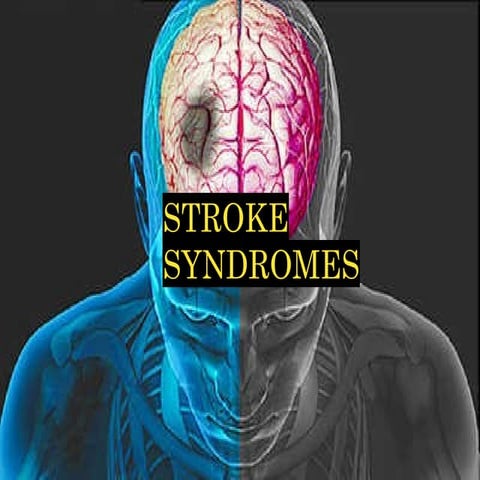STROKE AND ITS TYPES - PATHOLOGY LECTURE | PPTX