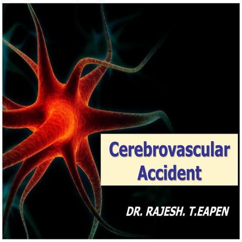 Stroke cerebrovascular accident | PPT