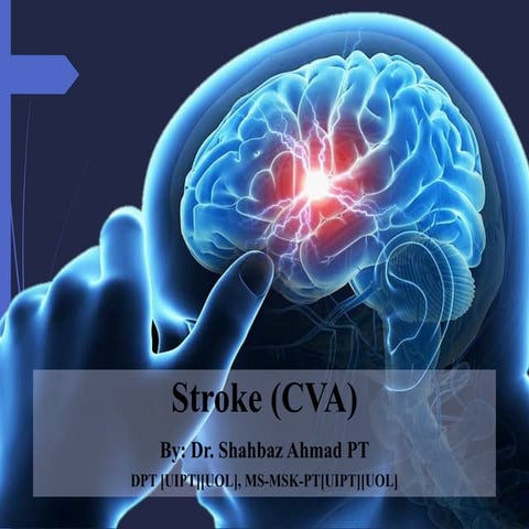 Stroke (cva) , CVA, Cerebrovascular Accident, Transient Ischemic Attack | PPT