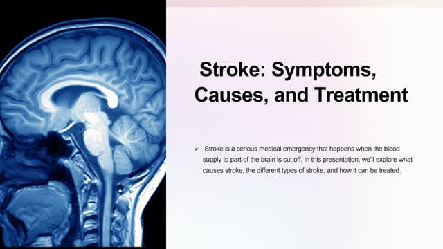 STROKE PRESENTATION NOTES IN POWERPOINT. | PPTX
