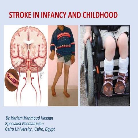 Stroke in infancy and childhood | PPT