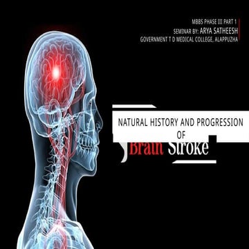 Stroke (Natural History, Progression).pptx