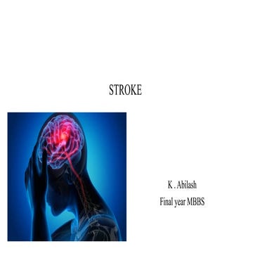 Management of stroke and it's clinical importance | PPTX