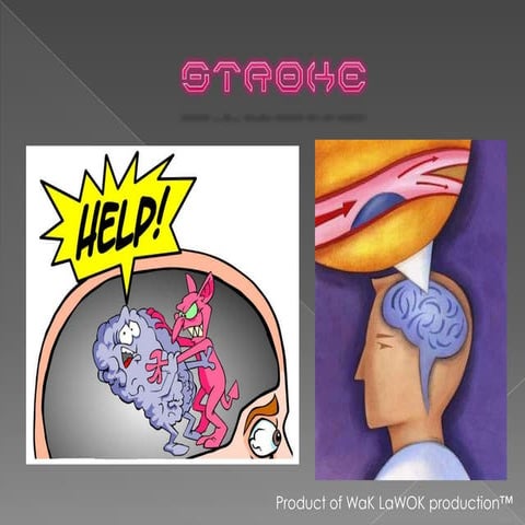 Stroke presentation | PPTX | Brain and Nervous System Disorders ...