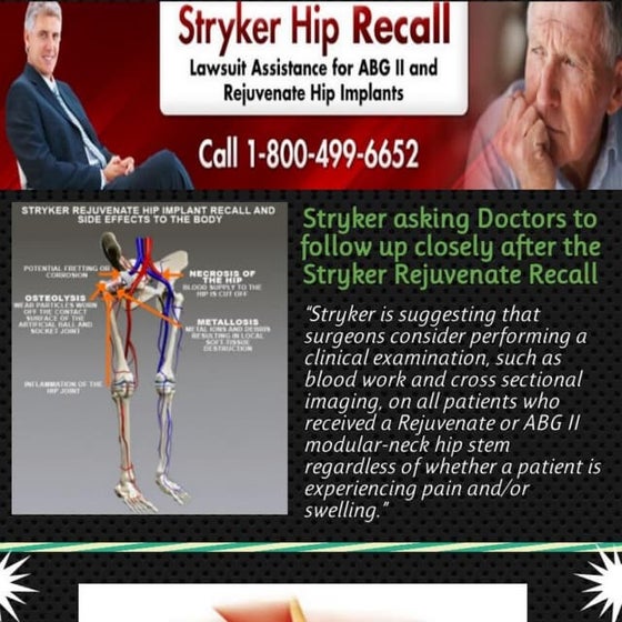 Stryker hip replacement | PDF