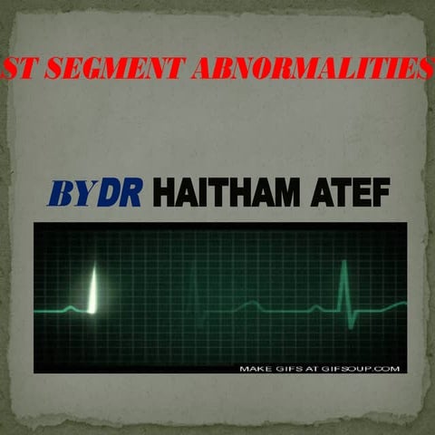 ST segment changes WORKSHOP on 2023 discussed and explained changes diagnosing acute im | PPTX
