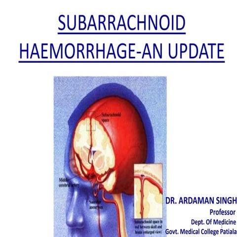 Subarachnoid haemorrhage | PPTX