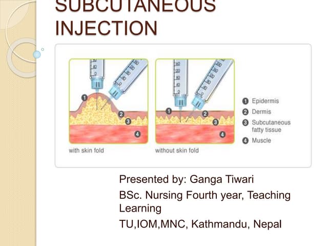 Intradermal injection- Introduction, procedure,complications | PPTX