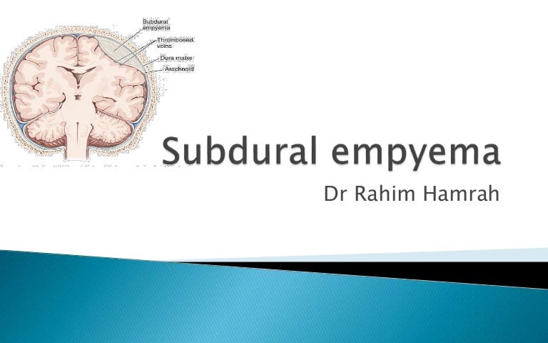 Subdural Empyema