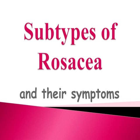 Rosacea: Inflammatory condition in Dermatology | PPTX