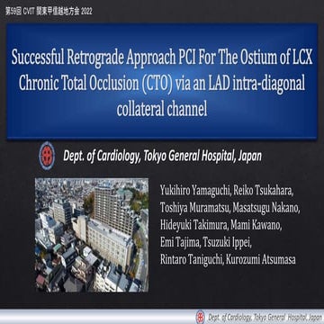 Successful Retrograde Approach PCI For The Ostium of LCX Chronic Total Occlusion (CTO) via an ...