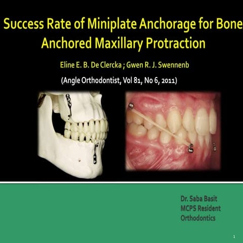 Success rate of miniplate anchorage for bone anchored maxillary protraction | PPTX