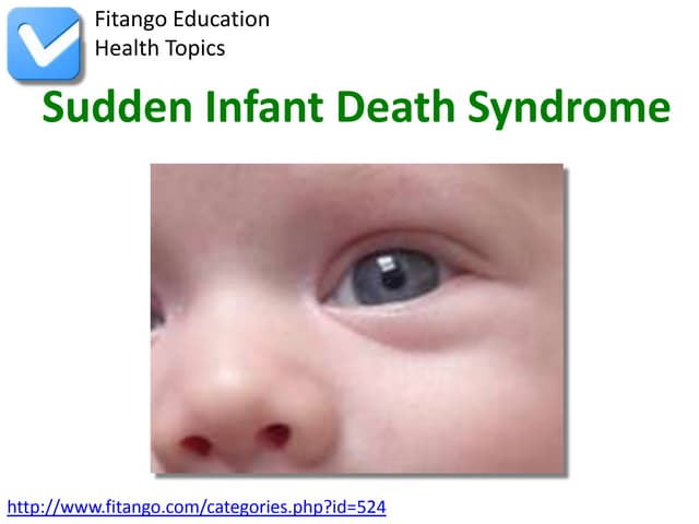 Sudden infant death syndrome | PPTX