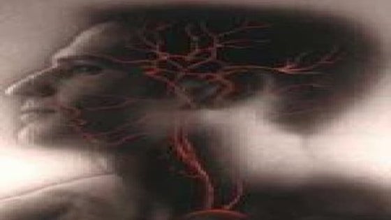 Gradual loss of vision (opthalmology) | PPT