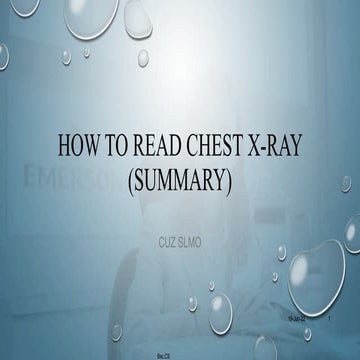 SUMMARY ON HOW TO READ CHEST X-RAY.pdf