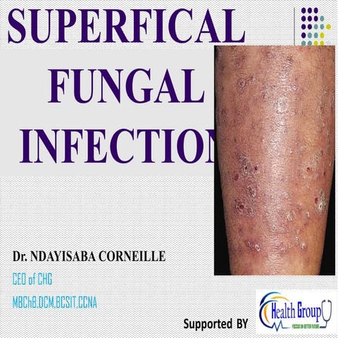 Superficial fungal infections.pdf | Skin Care | Beauty